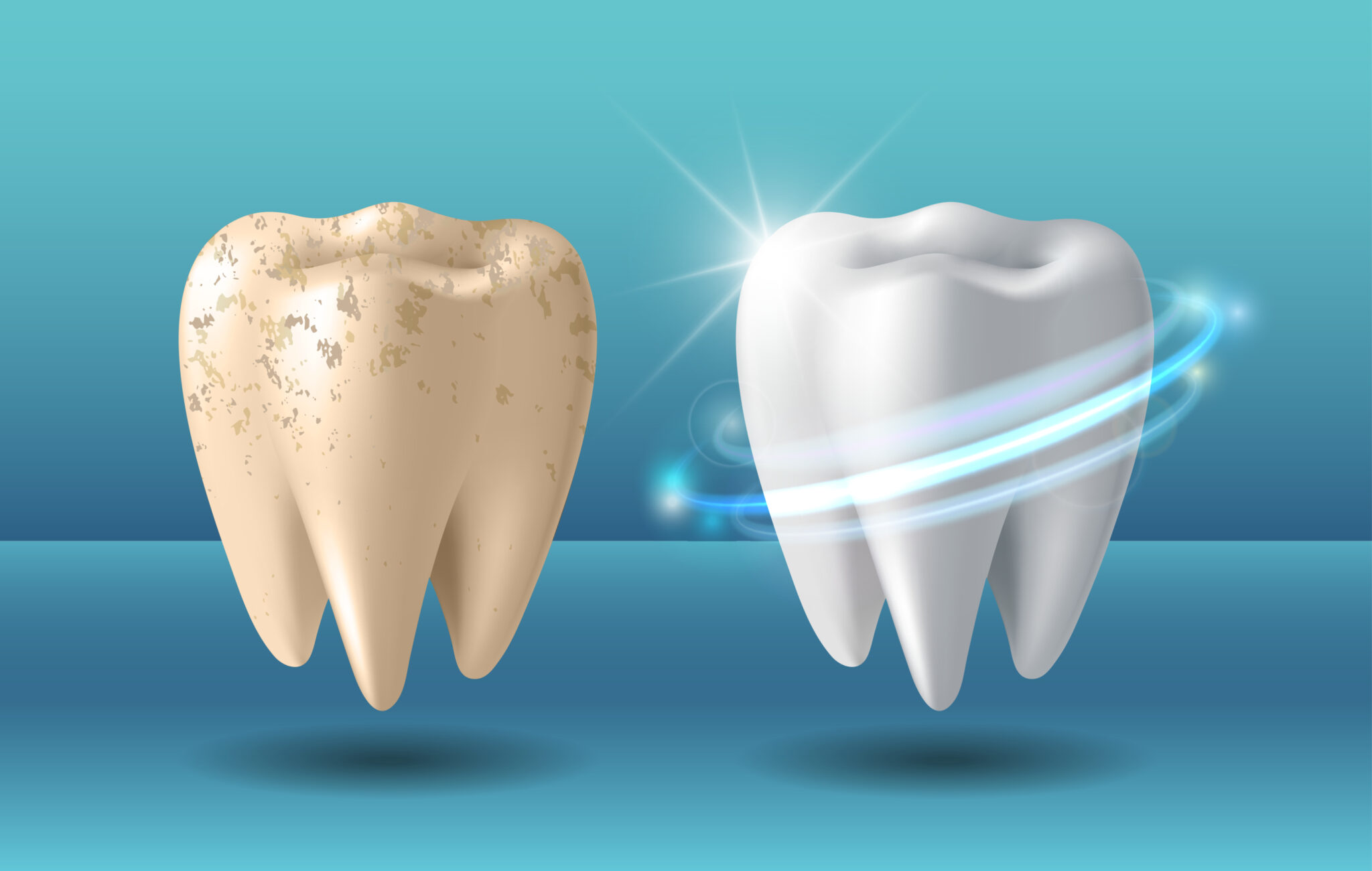 Prevention Methods That Can Help Save Your Tooth - Torbram Dental